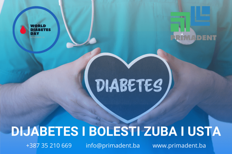 Dijabetes i bolesti zuba i usta - Stomatološka ordinacija Tuzla Primadent